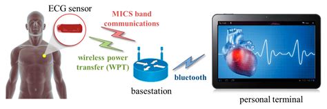 Wireless Ecg Monitoring Project At Kyle Melvin Blog