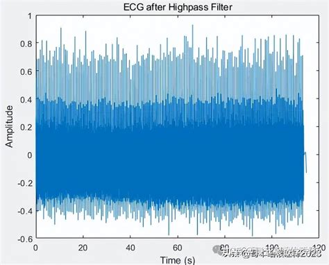 基于窗函数的FIR滤波器设计及信号降噪应用MATLAB 知乎
