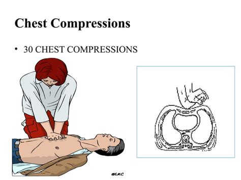 Advanced Cardiac Life Support Acls Shockable Non Shockable Rhythm