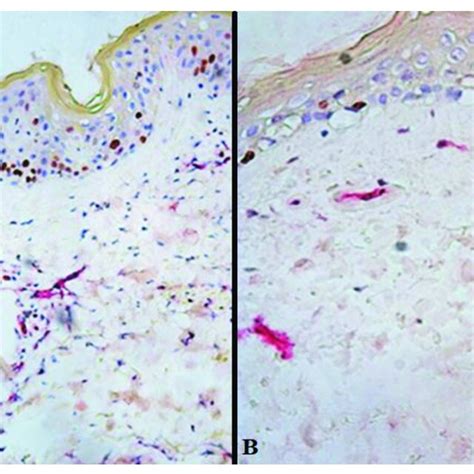 Histological Structure Of Split Thickness Skin Grafts And Underlying Download Scientific