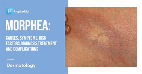 Morphea Morphea Mushq Pakistan