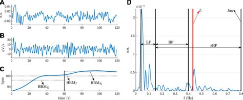 Hrv Analysis During The 2mwt A Hrv Signal B Edr Signal C Hr