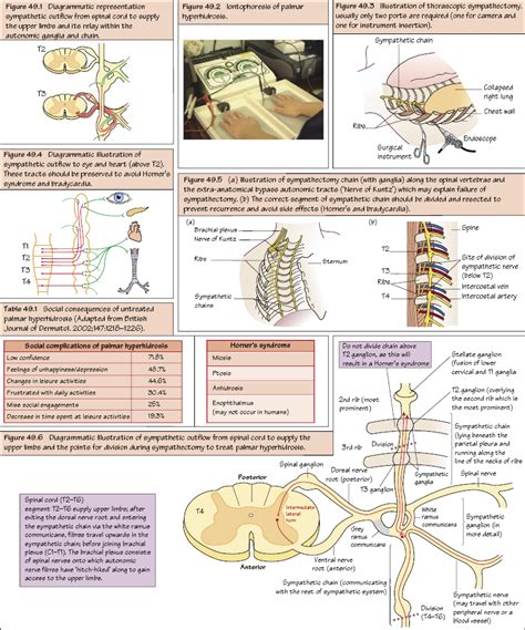 Coagulopathy And Thrombophilia Thoracic Key