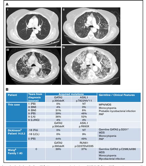 Figure 1 From Can Somatic Gata2 Mutation Mimic Germ Line Gata2 Mutation Semantic Scholar