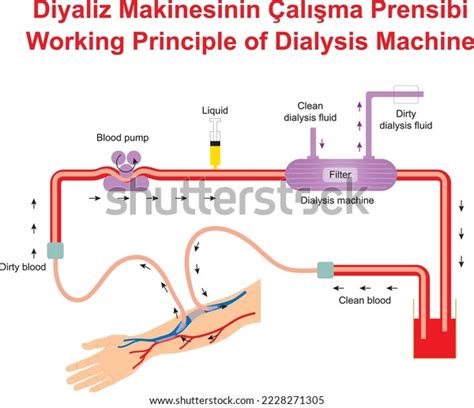 Working Principle Dialysis Machine Stock Vector Royalty Free 2228271305 Shutterstock