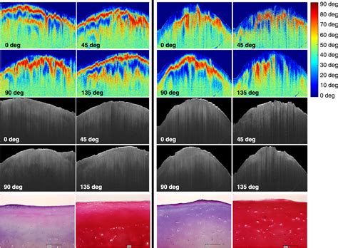 Polarization Sensitive Optical Coherence Tomography Based Imaging