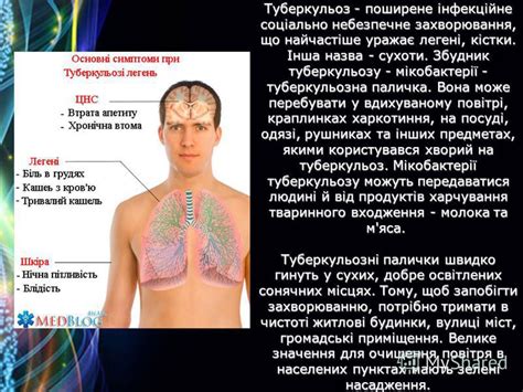 Презентация на тему Презентація на тему Захворювання дихальної