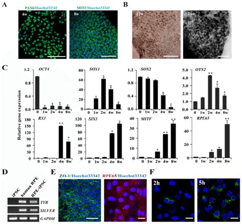 Rpe Cells Derived From Ipscs And Characterization Of Ipsc Derived Rpe Download Scientific