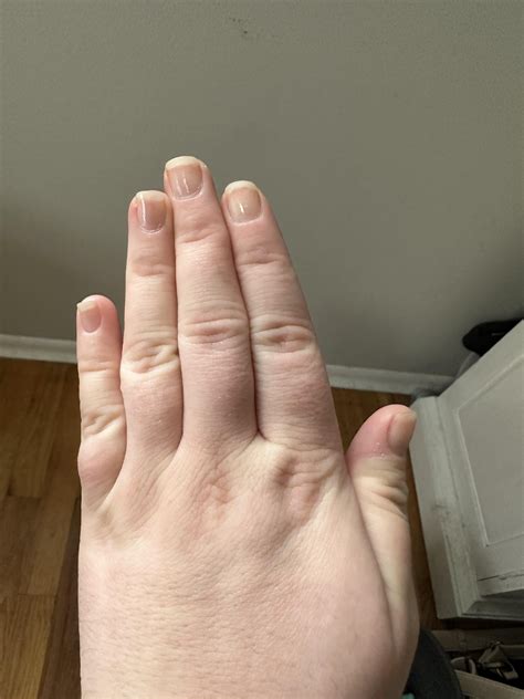 4 Months Without Biting And This Month I Faced My Biggest Challenge A