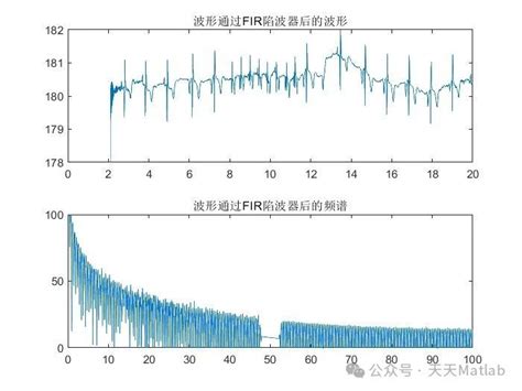 【心电信号】基于fir滤波器和iir滤波器巴特沃思，切比雪夫，椭圆滤波器实现心电信号预处理附matlab代码fir滤波器和巴特沃斯滤波器