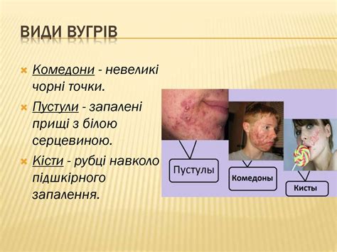 Функціонування шкіри у підлітковому віці презентация онлайн