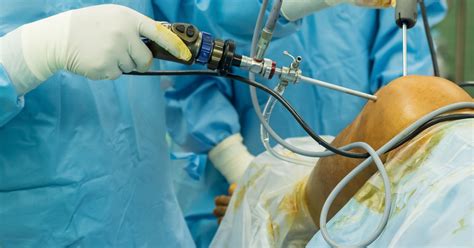 Acl Reconstruction Purpose Preparation Procedure And Faqs