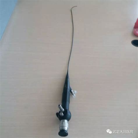 我院引进全进口输尿管软镜治疗