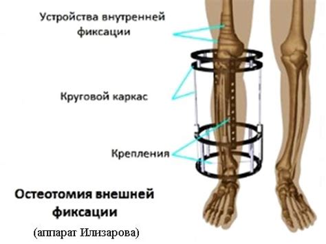 Ленивый фитнес аппарат результаты до и после фото