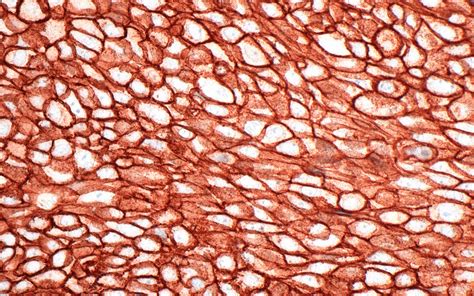 Her2 Protein Light Micrograph Stock Image C0571459 Science
