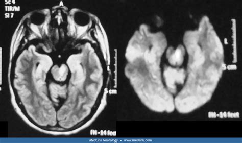 85216590 Medlink Neurology