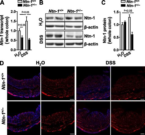 Netrin 1 Expression And Enteric Neuronal Patterning In Mice With