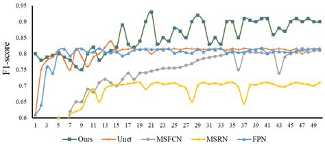Mathematics Free Full Text Osteosarcoma Mri Image Assisted Segmentation System Base On