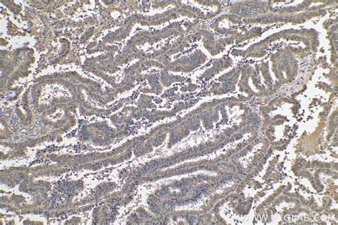 Ihceasy Ahcy Ready To Use Ihc Kit Khc0776 Proteintech 武汉三鹰生物技术有限公司