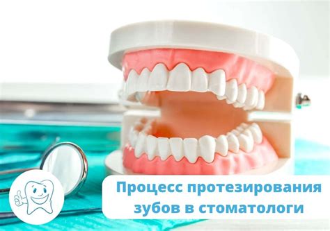Процесс протезирования зубов в стоматологических клиниках Подольска шаг за шагом Стоматология