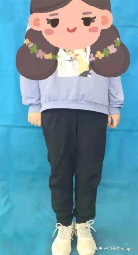 腿型难看怎么办罗圈腿需要矫正吗 知乎