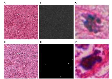 Figure From Deep Learning For Semantic Segmentation Vs Classification In Computational