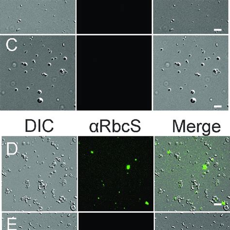 Pyrenoid Enriched Fractions Contain Pyrenoids As Revealed By If