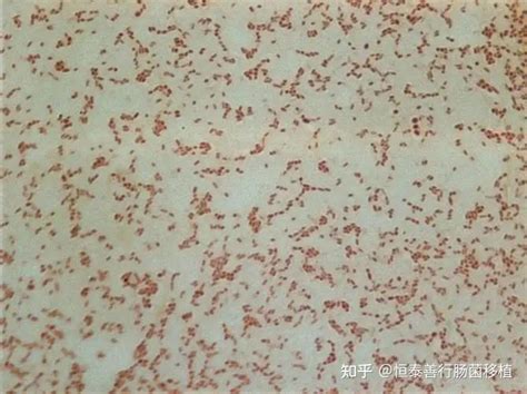 拟杆菌属 Bacteroides 知乎