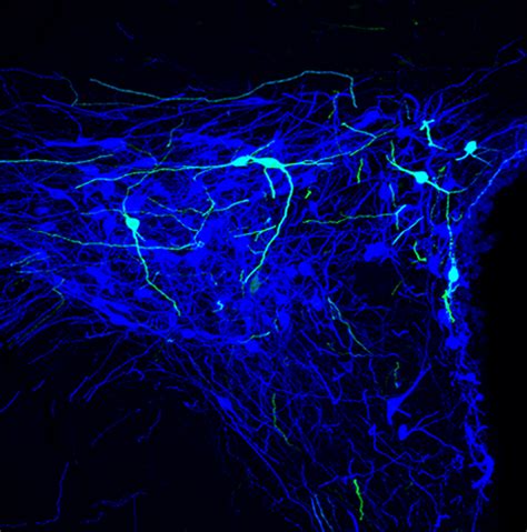 A New Population Of Parvocellular Oxytocin Neurons Controlling