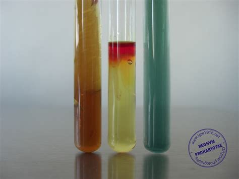 Regnum Prokaryotae Biochemical Tests