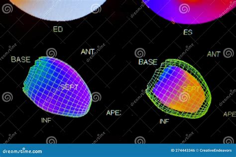 Color Adenosine Cardiac Stress Test Images On Black Background Stock