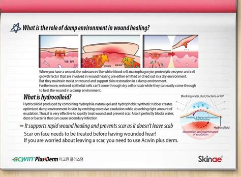 Acwin Plus Derm Moist Wound Dressing for Skin Trouble Ance Pimple Care ...