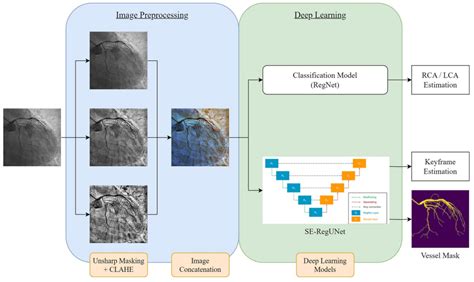 结合创新！通道注意力unet，实现高精度分割se Swin Unet For Image Segmentation Of Major