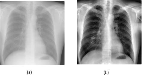 A Is The Original Image And B Is The Image With Contrast Limited