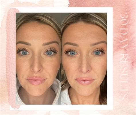 Skincare Ashley Erickson Beauty
