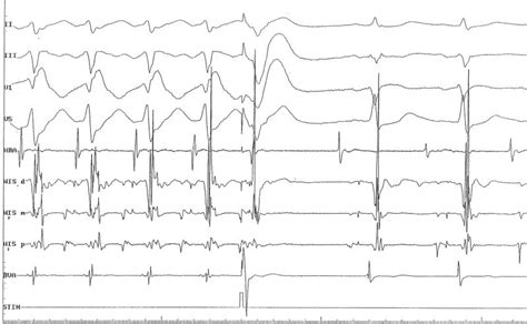 Chart Healthcare Academy On Linkedin Sundayschool Ceps Rces Epeeps