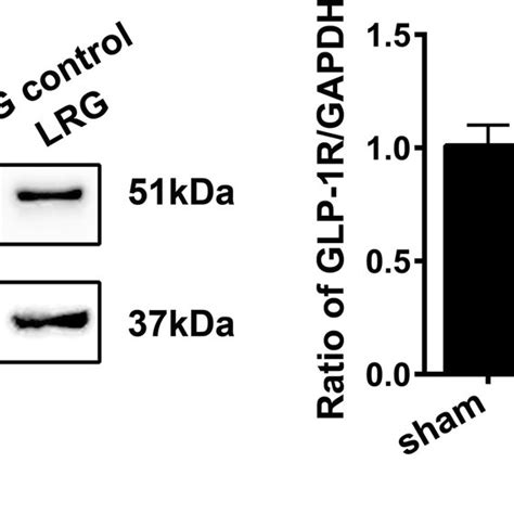Liraglutide Promotes Autophagy Western Blot Analysis For Lc3 P62 And