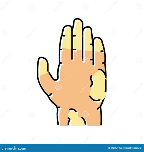 Scleroderma Cartoons Illustrations And Vector Stock Images 421