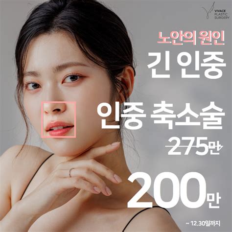 비바체성형외과💕 티안나게 예뻐지는법 알아볼까요 이벤트 비바체성형외과