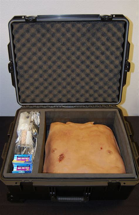 Needle Decompression Kit