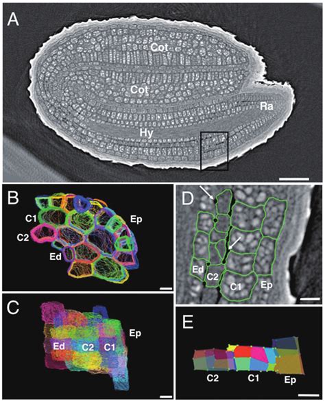 Extracting Outlines Of Epidermal And Cortical Cells In The Hypocotyl Of