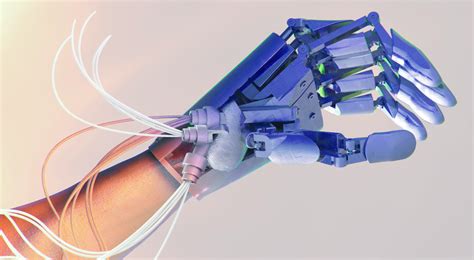 What Neuralinks Testing Could Mean For Prosthetics Cybernews