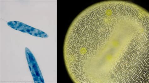 Clostridium Under Microscope Biology Notes Online