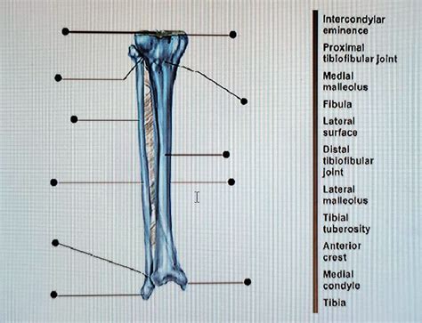 Solved Intercondylar Eminence Proximal Tibiofibular Joint Medial