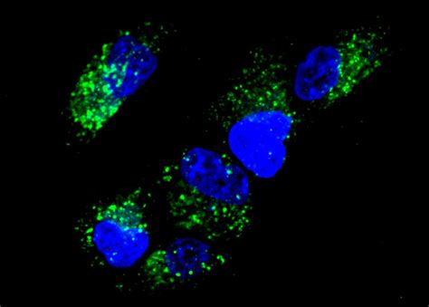 Scientists Demonstrate Basics Of Nucleic Acid Computing Inside Cells