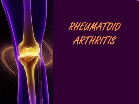 Ppt Rheumatoid Arthritis Powerpoint Presentation Free Download Id