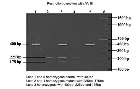 Part 2 Analysing And Interpreting Agarose Gel Electrophoresis Results
