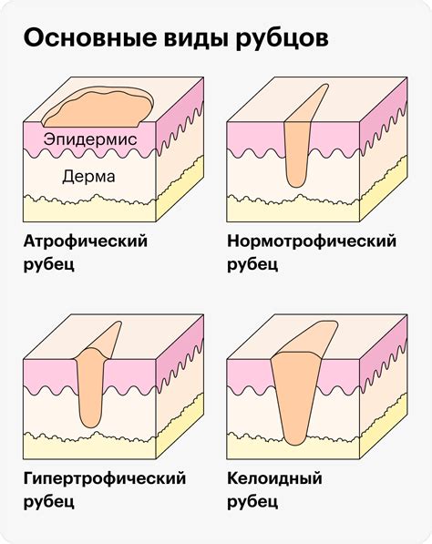 Как избавиться от шрамов сделать менее заметными скрыть и