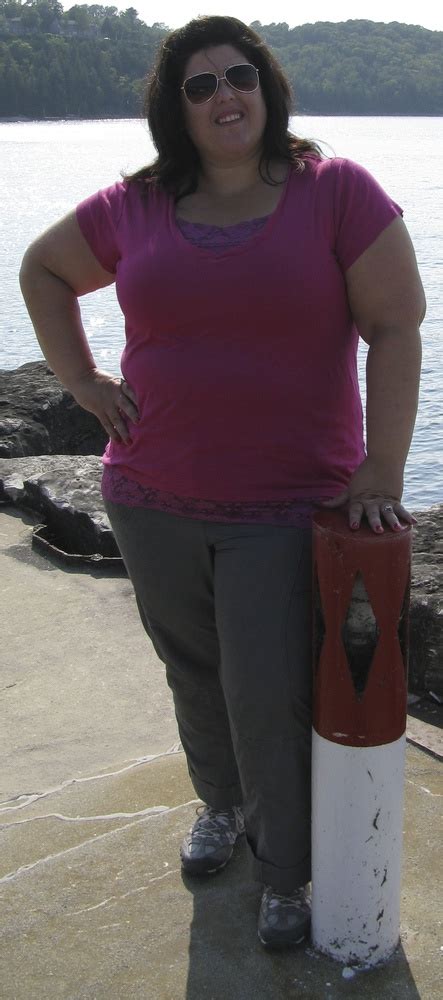 Excess Skin After Weight Loss Surgery On Nhs Jobs Desertposts