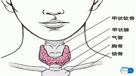 怎樣治療甲狀腺瘤？ 每日頭條